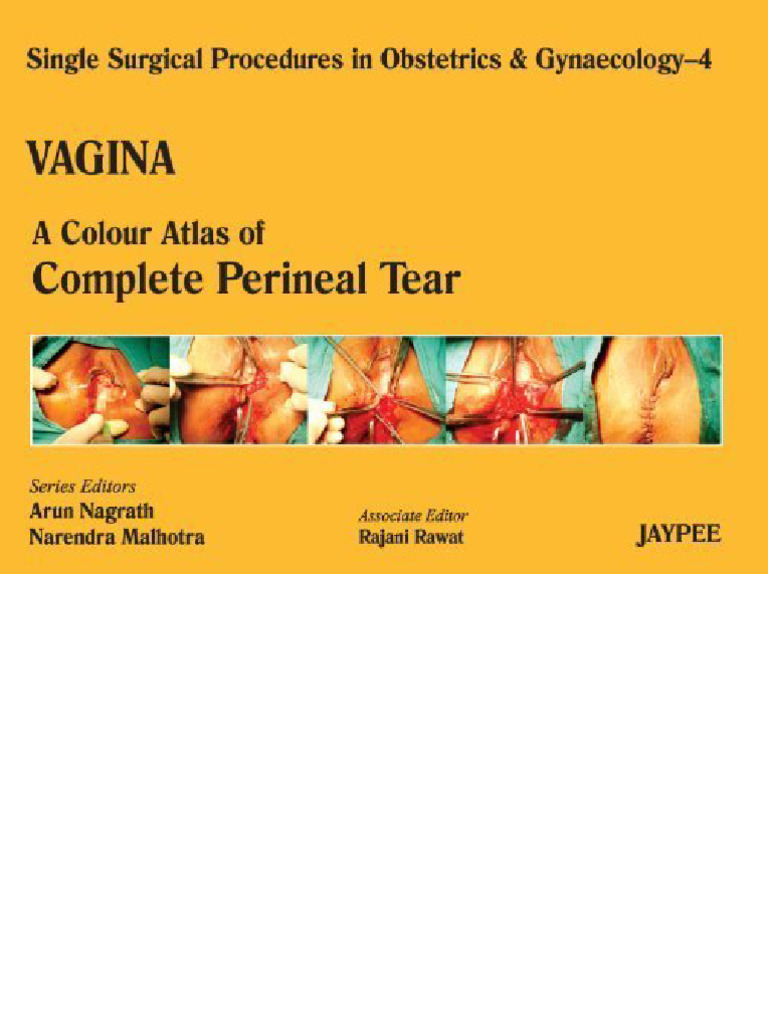 A Colour Atlas of Complete Perineal Tear | PDF | Rectum | Vagina