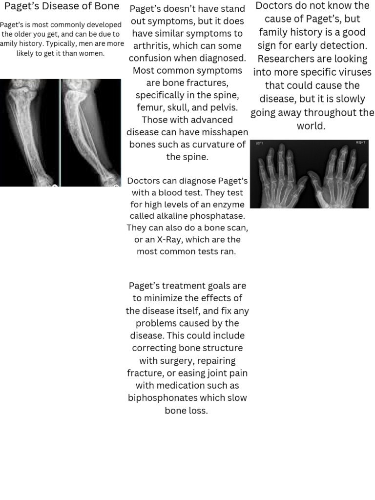 Paget's Disease | PDF