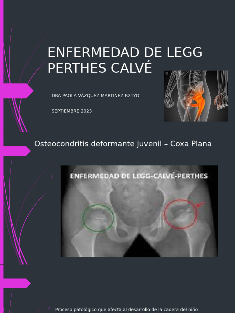 Enfermedad Legg-Calvé-Perthes: Diagnóstico y Clínica | PDF | Causas de ...