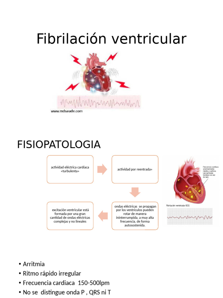 Fibrilación Ventricular Causas Y Ecg Pdf