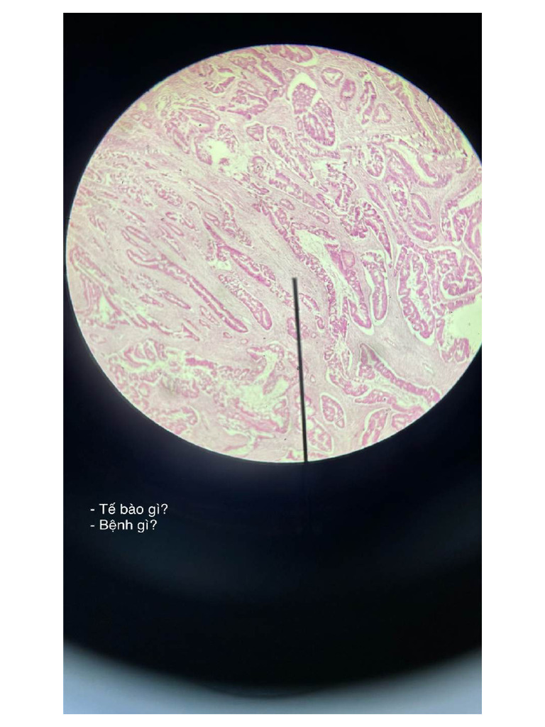 10 TR M Thi TH GPB | PDF