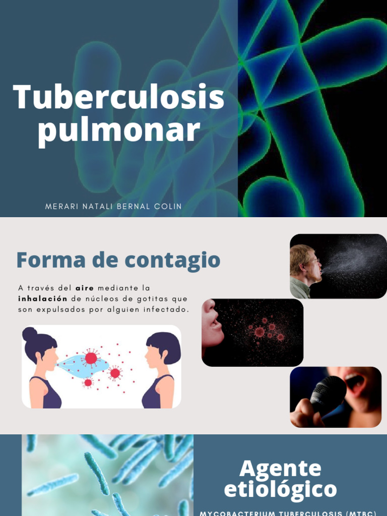 Tuberculosis Pulmonar | PDF