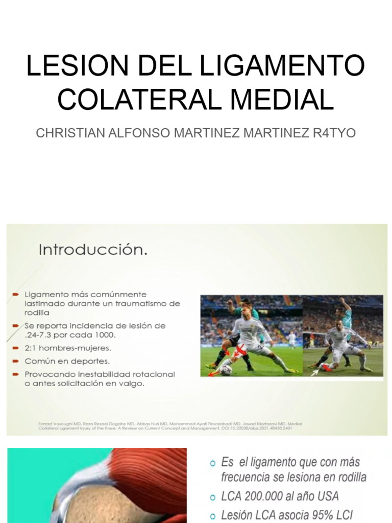 Lesión del Ligamento Colateral Medial | PDF | Tecnología