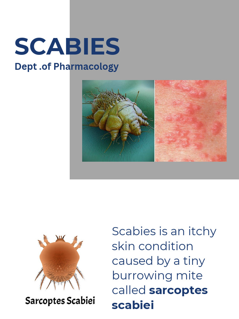 SCABIES - 20241106 - 200237 - 0000.pdf - 20241107 - 000729 - 0000 | PDF ...
