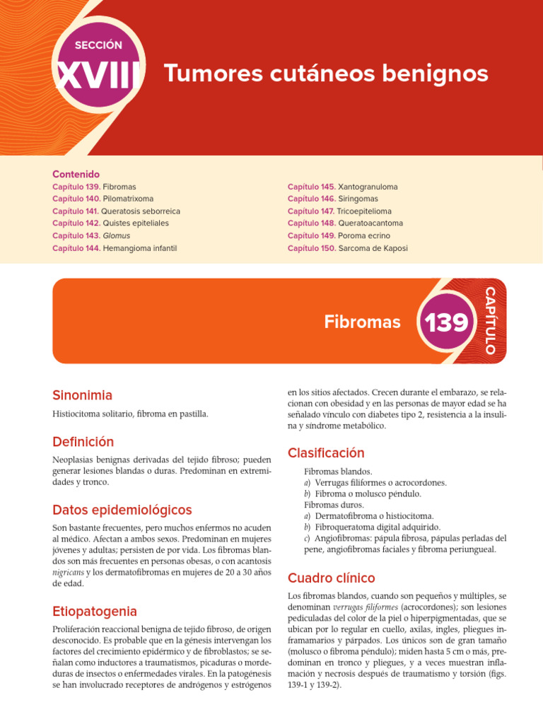 Tumores Benignos | PDF | Neoplasias | Tumor benigno