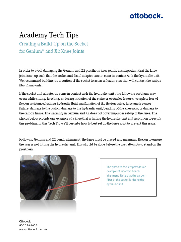 techtip_148 | PDF | Knee | Prosthesis