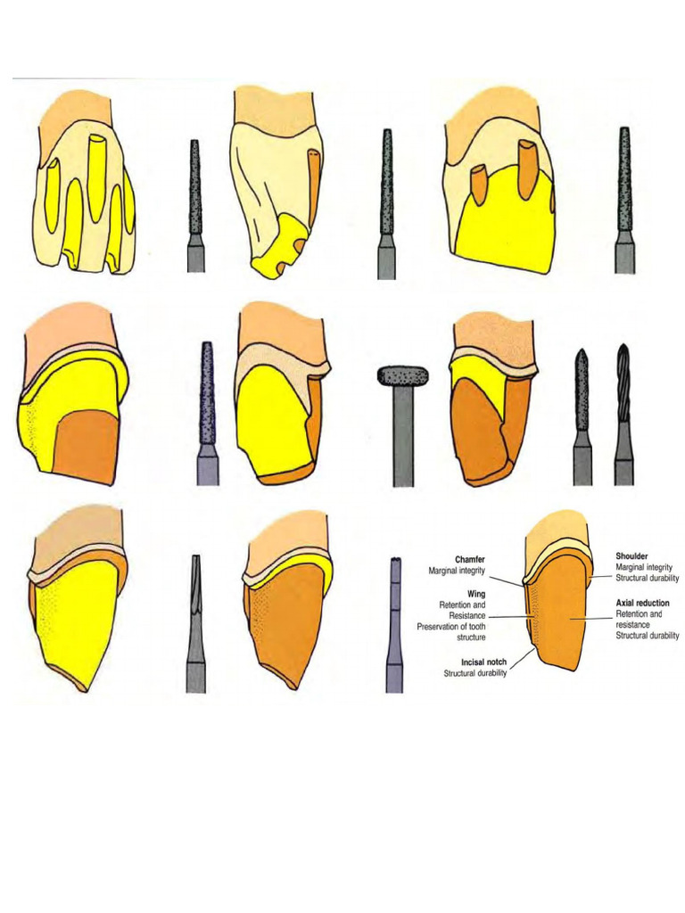 Prostho FPD Pics | PDF