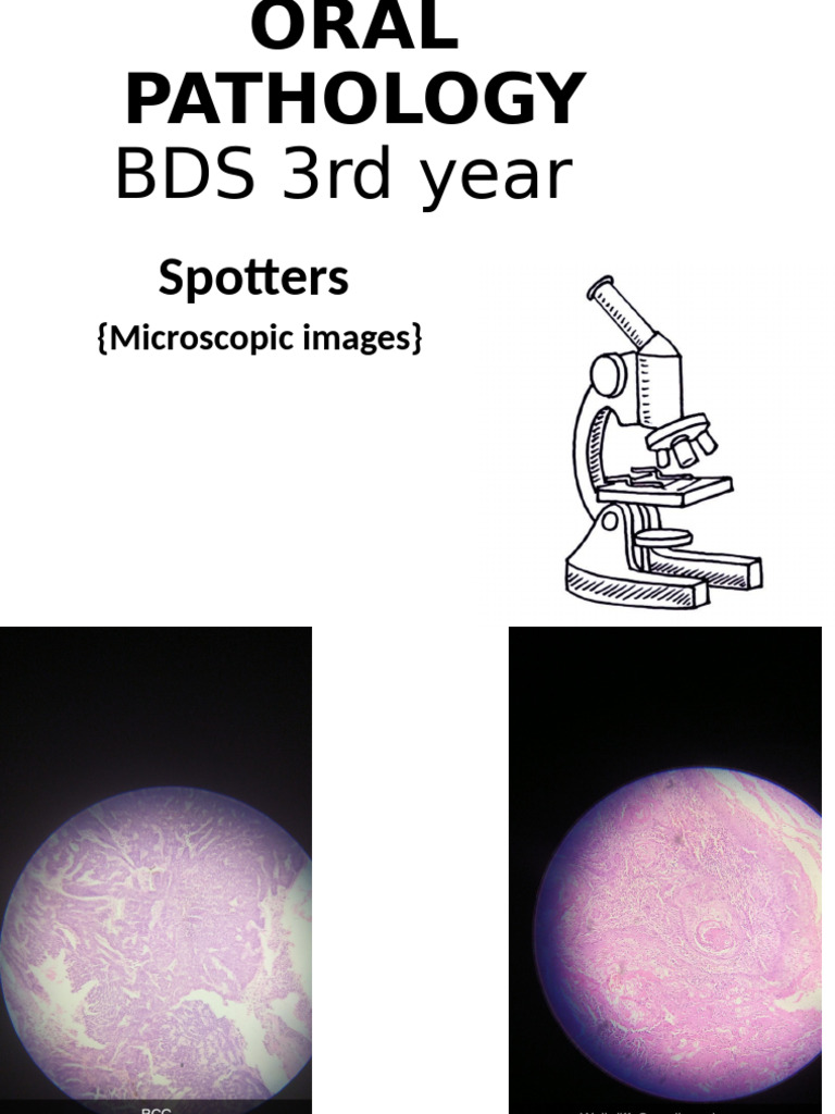 Oral Pathology Spotters | PDF | Science & Mathematics