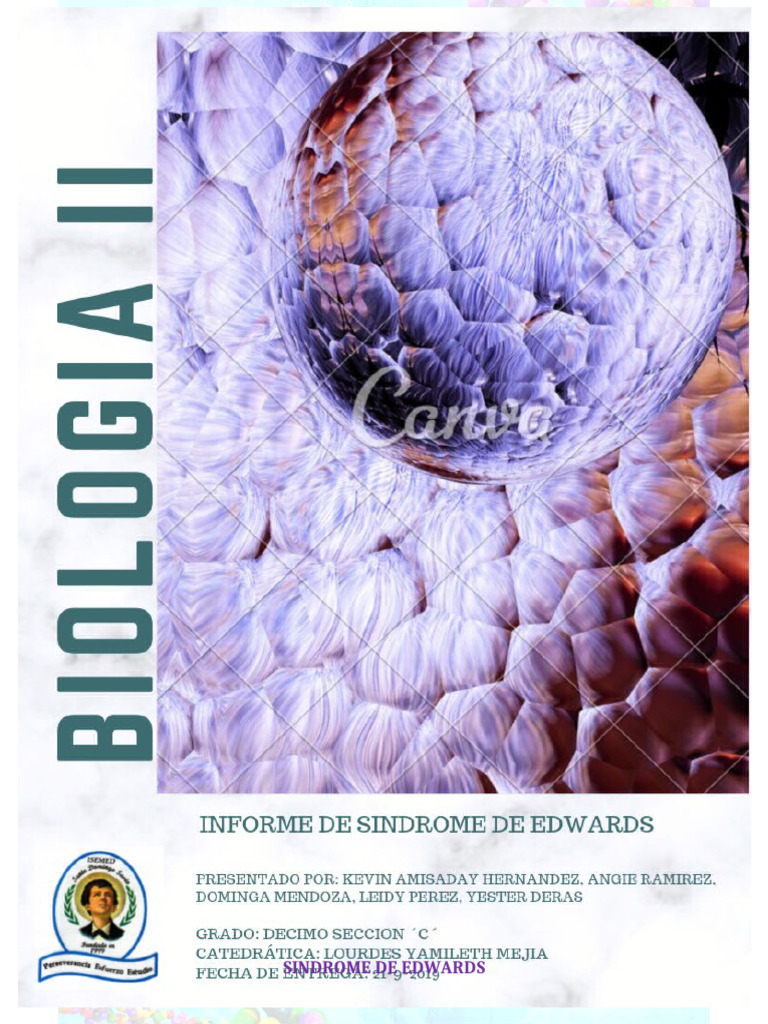 Trisomía 18: Síndrome de Edwards y sus Características | PDF | Causas ...