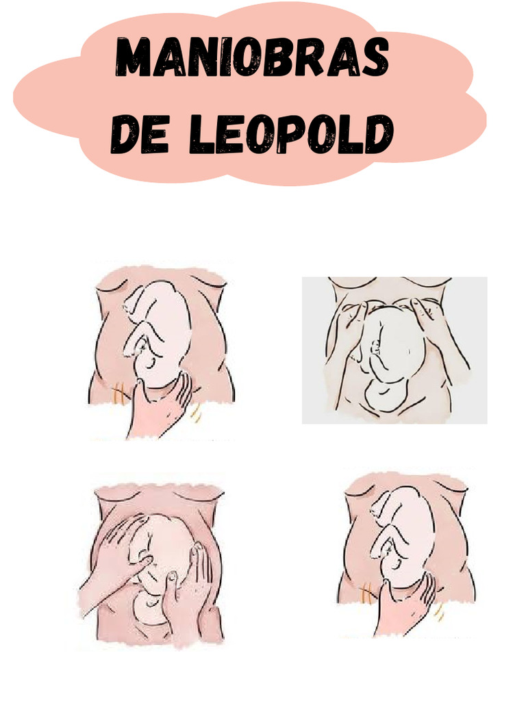 Maniobras de Leopold - 20241121 - 120048 - 0000 | PDF