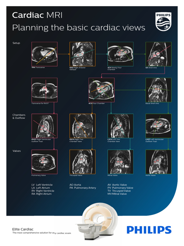 Poster - Planning Basic Cardiac Views | PDF | Heart Valve | Ventricle ...