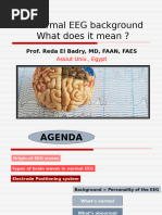 Abnormal EEG Report Samples Analysis | PDF | Electroencephalography ...