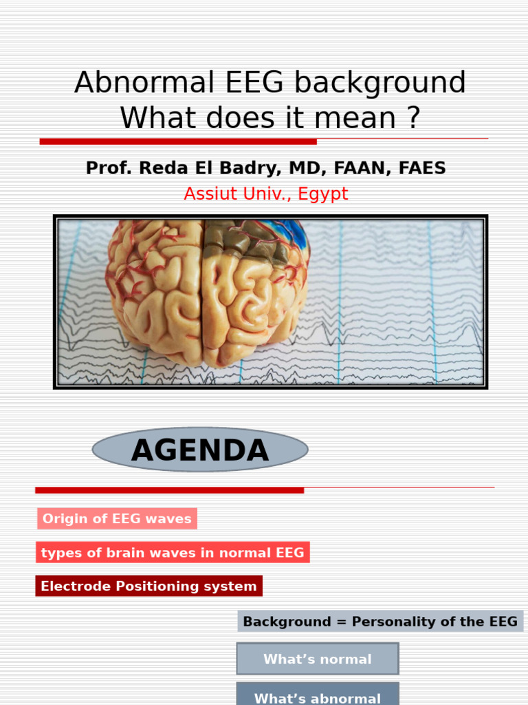 Abnormal Background in EEG | PDF | Electroencephalography | Neural ...