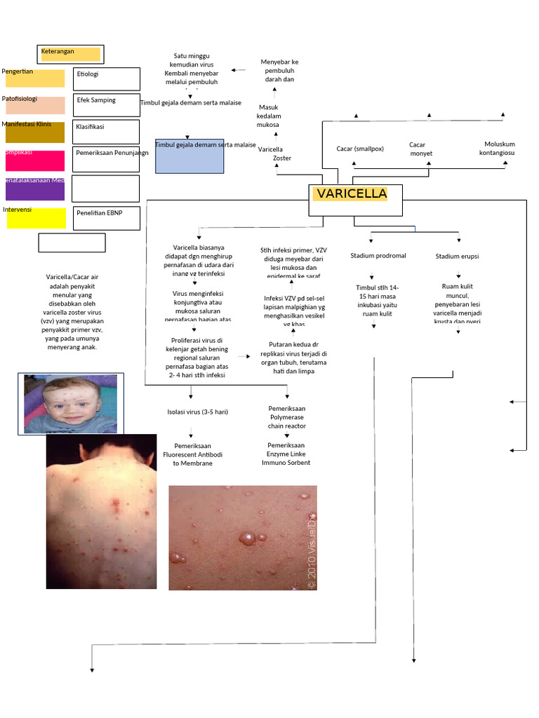 WOC Varicella-1 | PDF