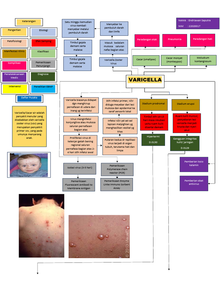 WOC Varicella-1 | PDF