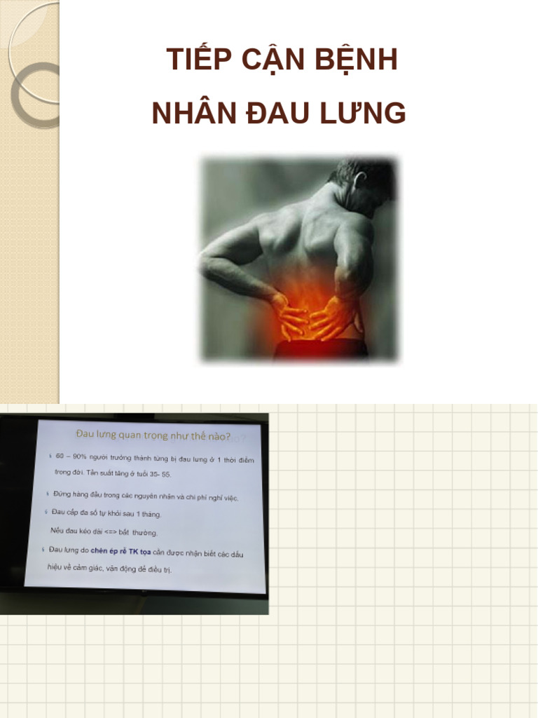 Bài 6 - Tiếp Cận BN Đau Lưng | PDF