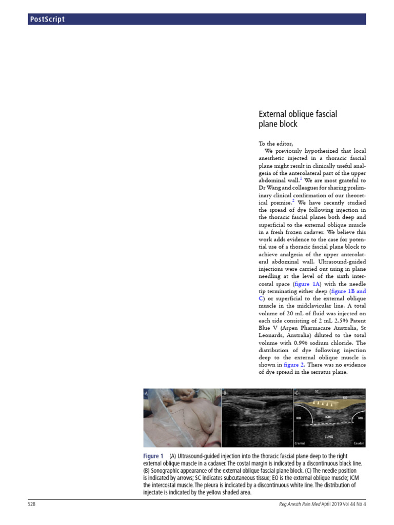 (Hamilton Et Al., 2019) External Oblique Fascial Plane Block. | PDF ...