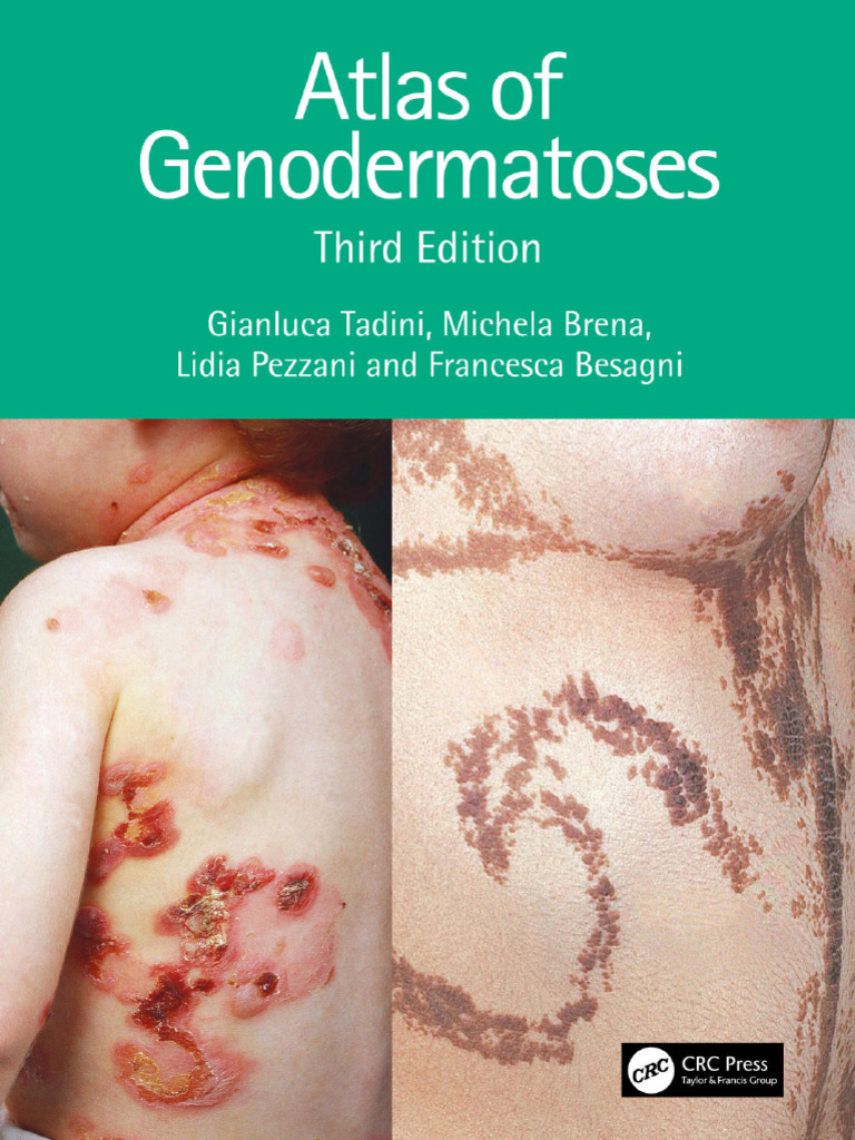 Atlas of Genodermatoses | PDF | Cutaneous Conditions | Human Diseases ...