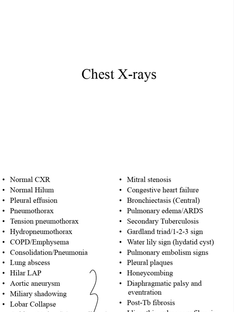 Comprehensive Guide to Chest X-rays | PDF