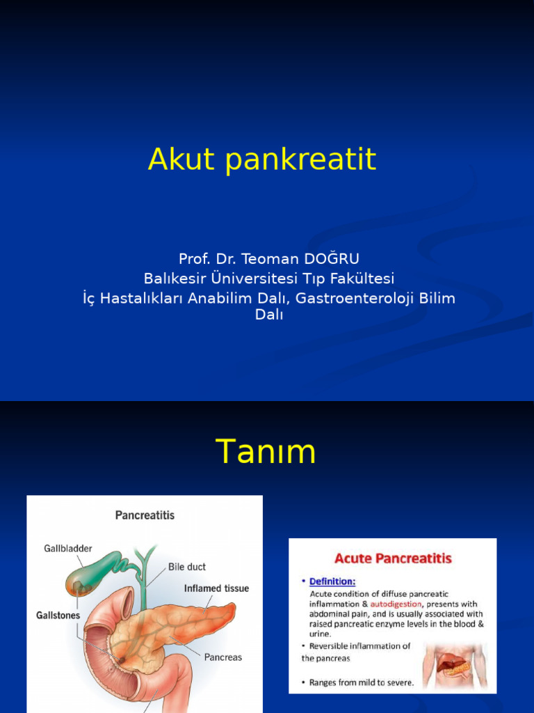 Akut Pankreatit | PDF