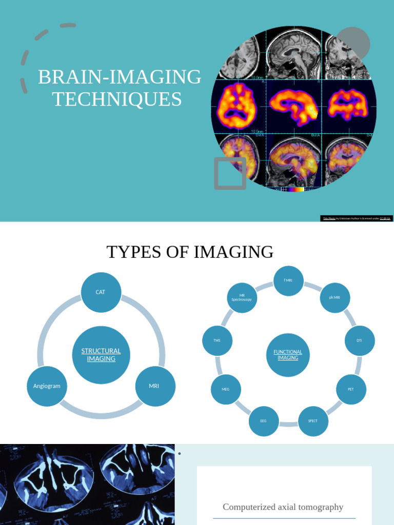 Brain Imaging Techniques Overview | PDF | Neuroimaging | Magnetic ...
