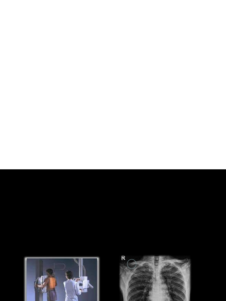 Clase - 4 - Torax RX-TC | PDF | Pulmón | Especialidades Medicas