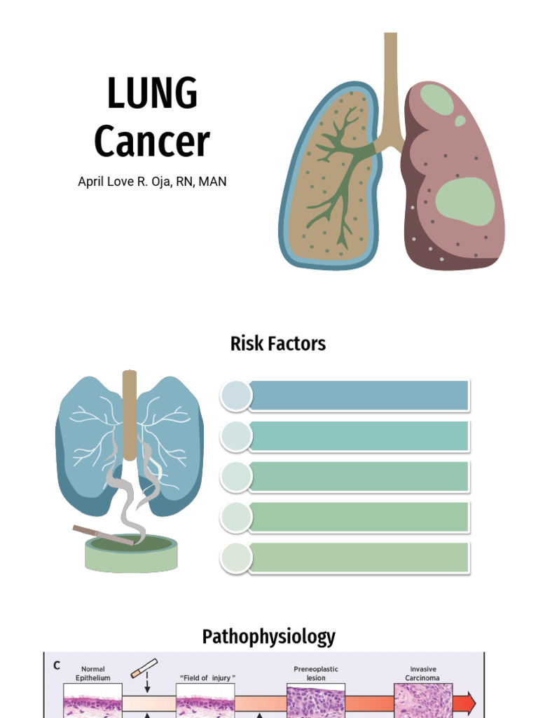 Lung-Cancer-F1 | PDF | Lung Cancer | Radiation Therapy