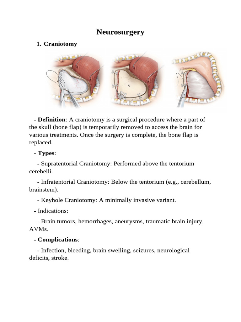 Neurosurgery | PDF | Implant (Medicine) | Stroke