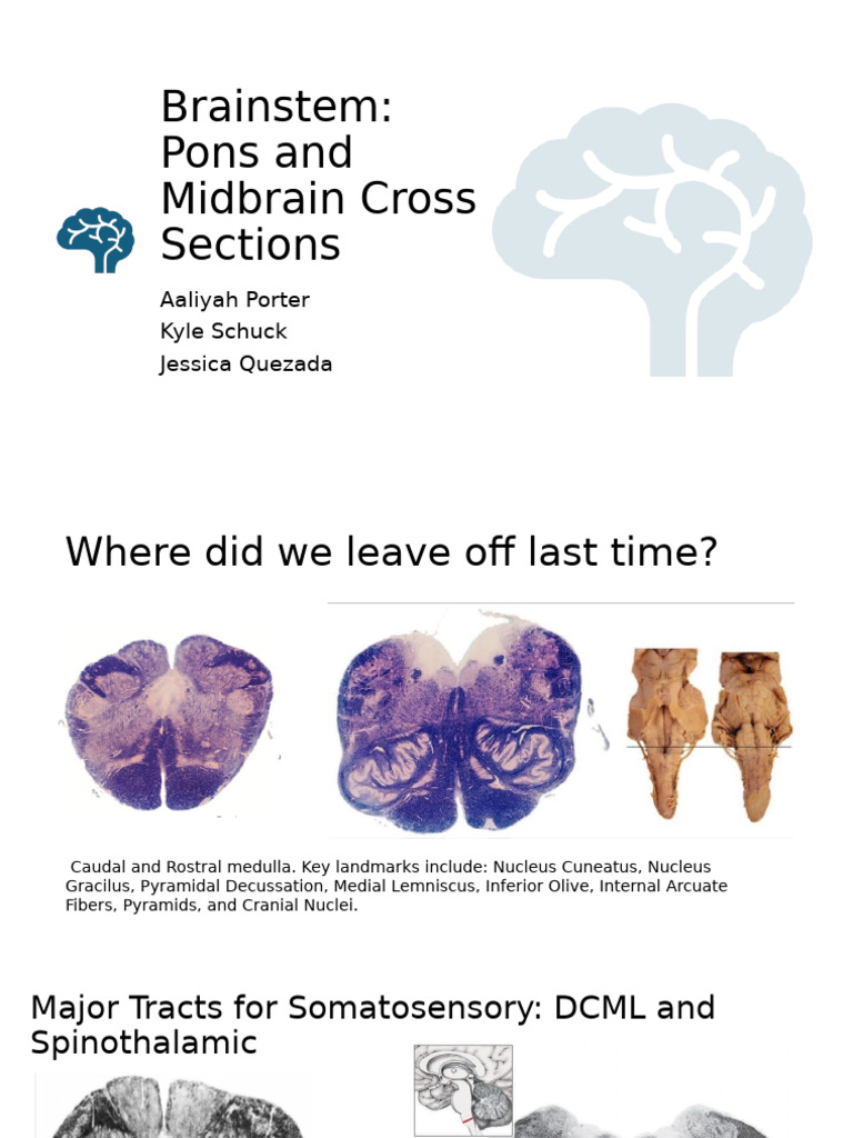 Presenation 2024 Brain Stem, Pons, and Midbrain Cross Section | PDF ...