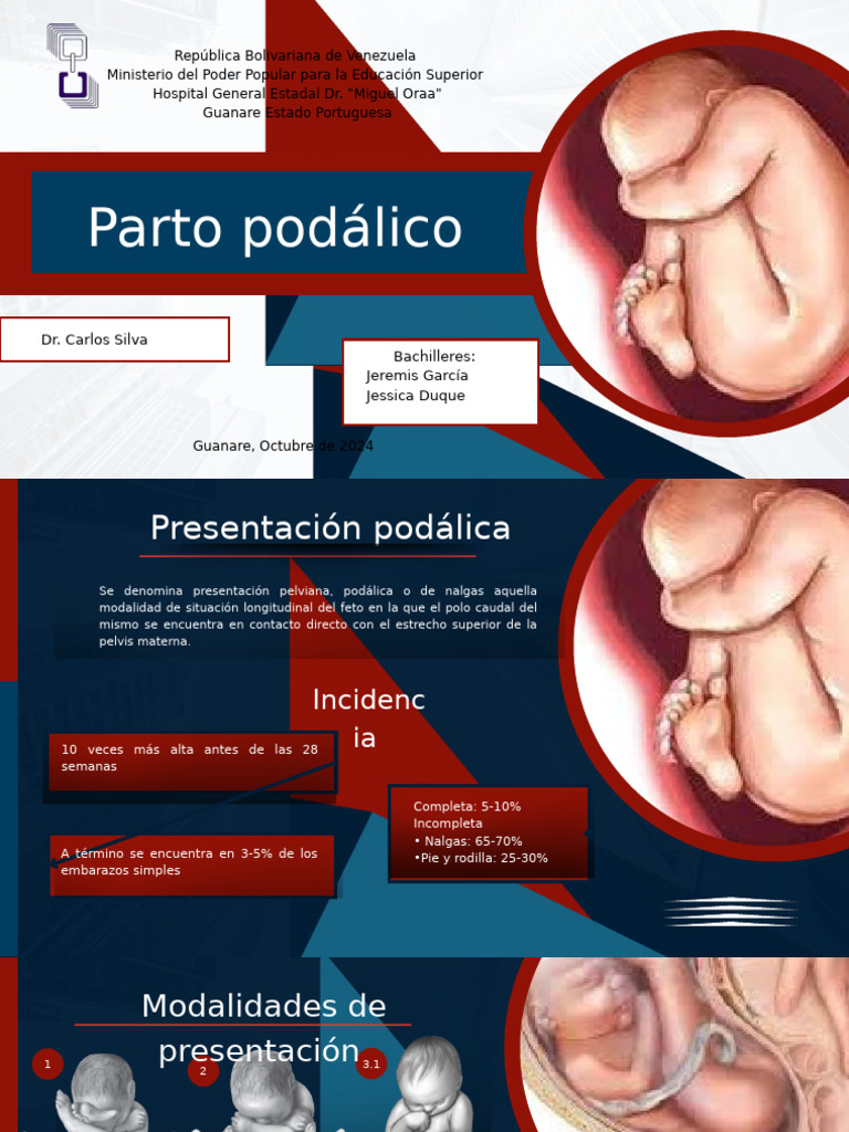 Parto Podalico - 20241023 - 063052 - 0000 | PDF | Parto | Feto