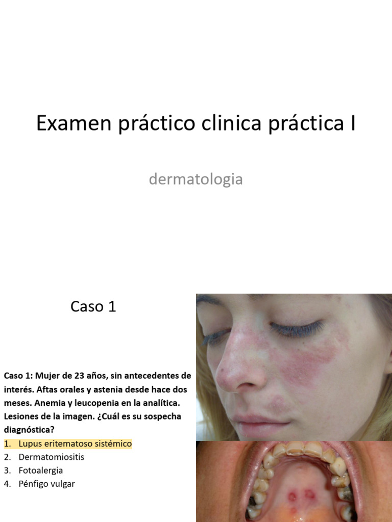 Imagenes Ecoe Derma Pablo | PDF | Psoriasis | Alergia