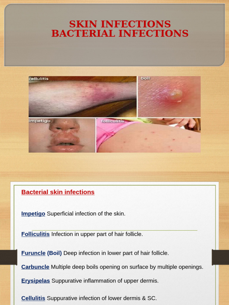 Bacterial Infections | PDF | Cutaneous Conditions | Medical Specialties
