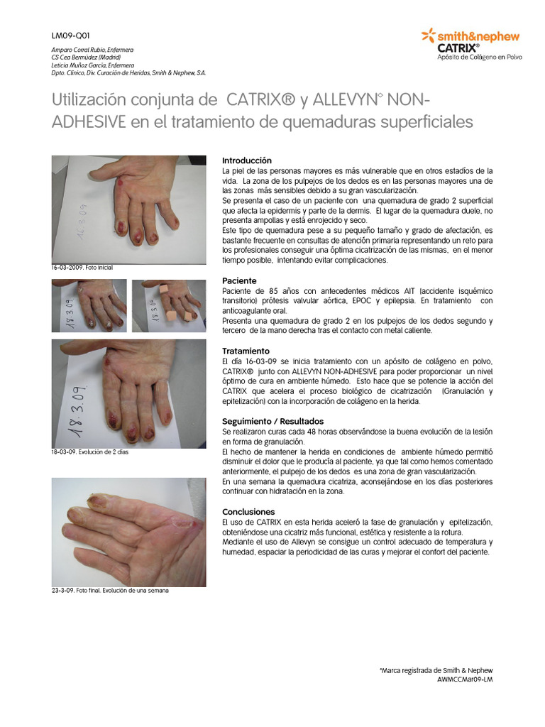 CASO CLÍNICO SMITH NEPHEW Quemadura Superficial Con CATRIX y ALLEVYN ...