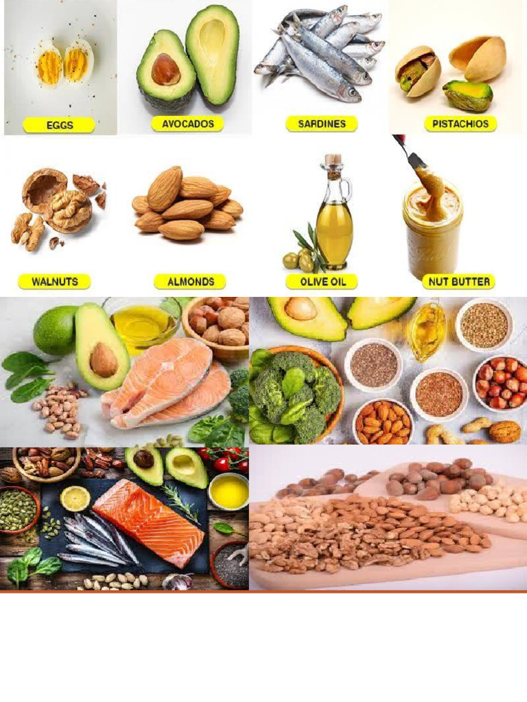 CHAPTER-5-LIPIDS-2 | PDF | Lipid | Fatty Acid
