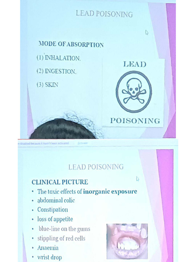(CM) Lead Poisoning | PDF