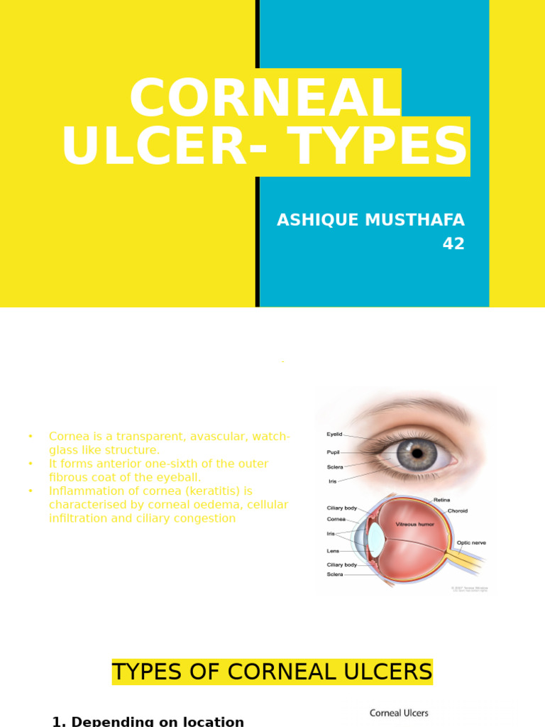 Ophthal 24 | PDF | Cornea | Immunology