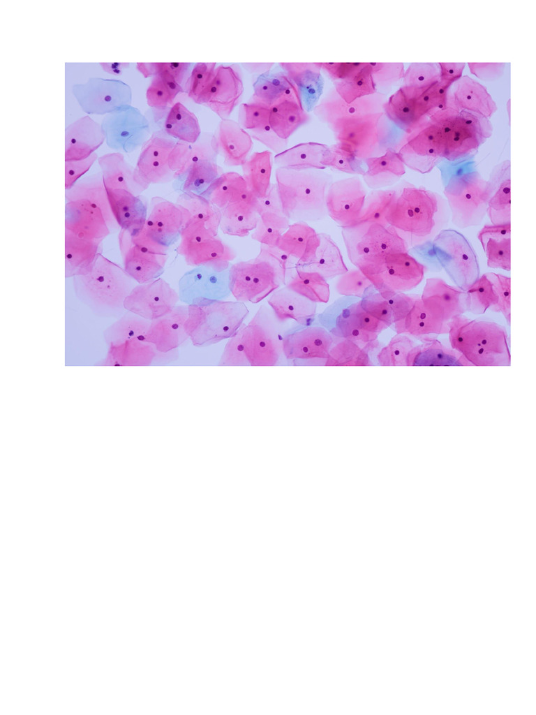 Cytology POL Charts With Key - 1 - 241104 - 113120 | PDF | Cervical ...