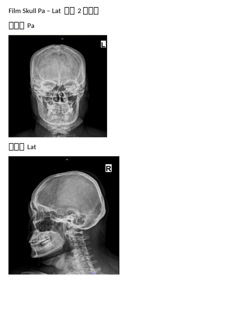 Film Skull AP | PDF