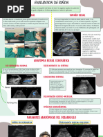 Grados de Varicocele: Clasificación y Evaluación | PDF | Sistema ...