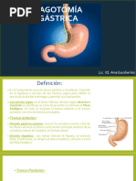 Sigmoidectomia Laparoscopica | PDF | Intestino grueso | Cirugía