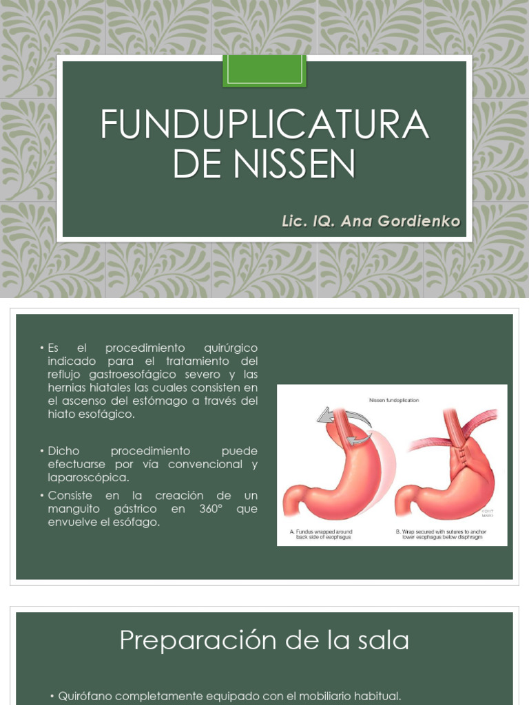 Nissen | PDF | Sistema digestivo | Abdomen