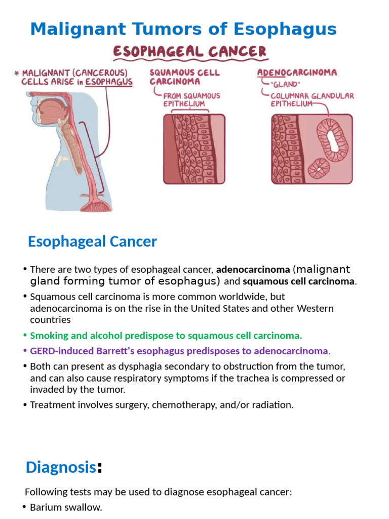 Malignant Tumors of Esophagus | PDF | Esophagus | Esophageal Cancer