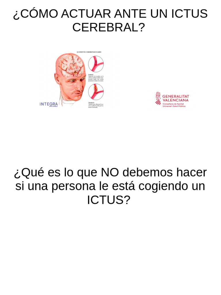 Como Actuar Ante Ictus Cerebral | PDF | Salud y bienestar | Ciencia y ...