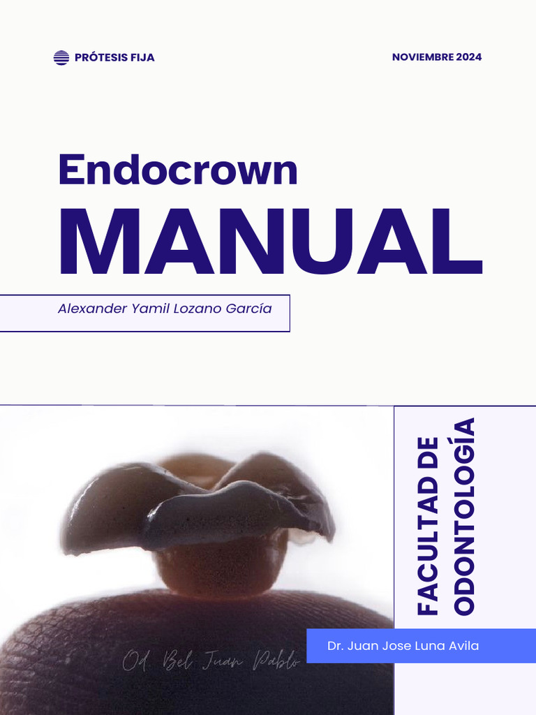 Endo Crown | PDF