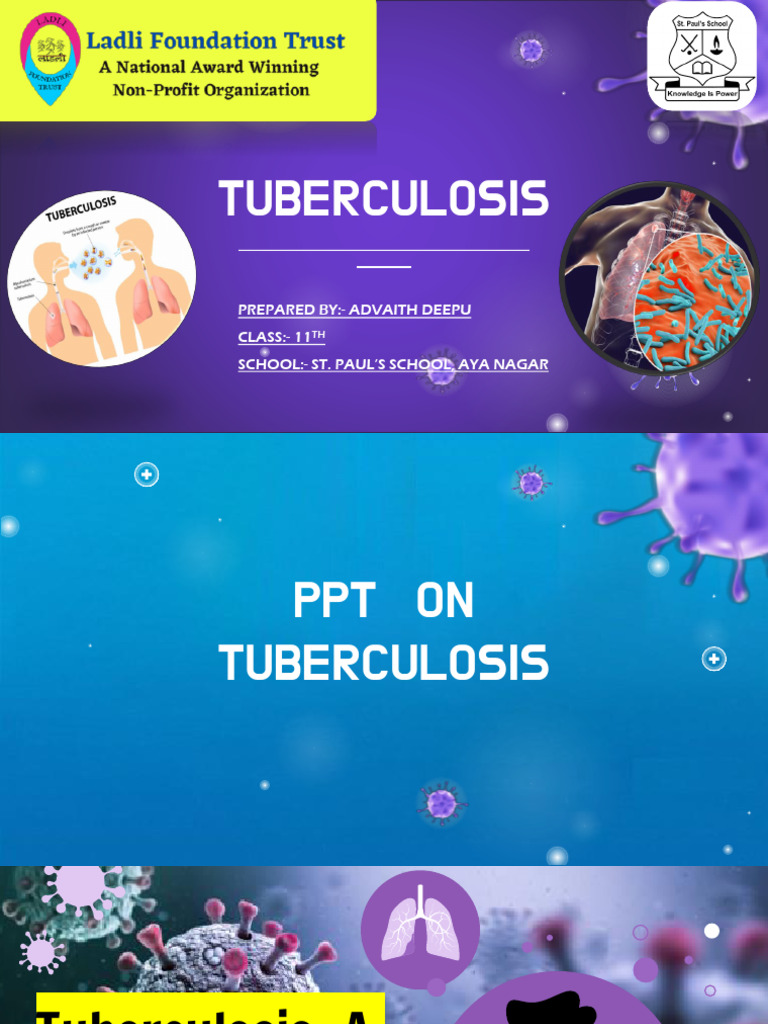 Tuberulosis Project | PDF | Tuberculosis | Infection