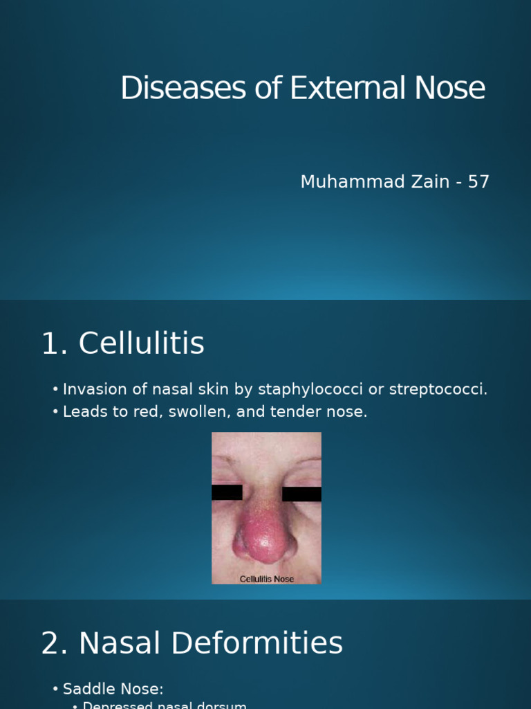 Diseases of External Nose | PDF | Human Nose | Causes Of Death