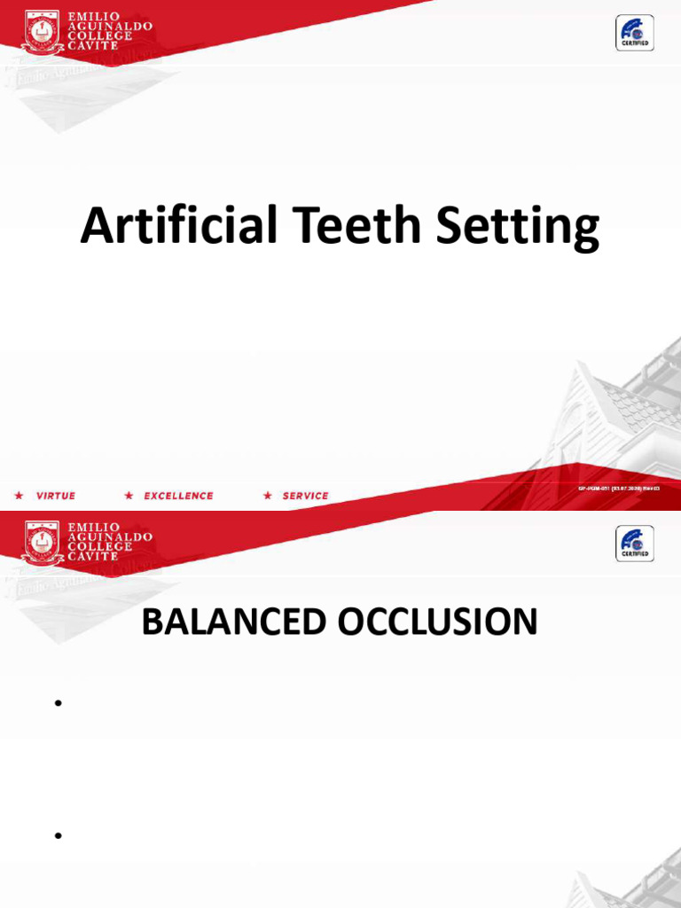 Artificial Tooth Setting in Complete Denture | PDF | Dentistry | Tooth