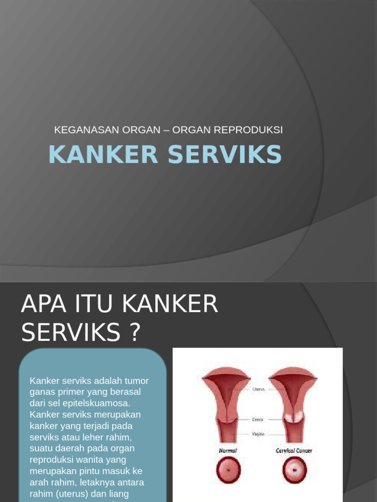 KANKER SERVIKS Kep Kes Reproduksi | PDF