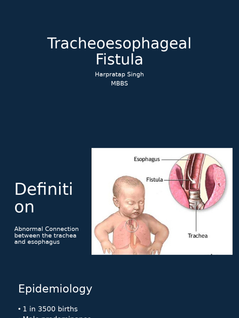 Tracheoesophageal Fistula | PDF | Diseases And Disorders | Clinical ...