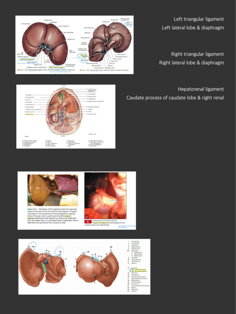 Surgery of The Liver 1 Summary | PDF